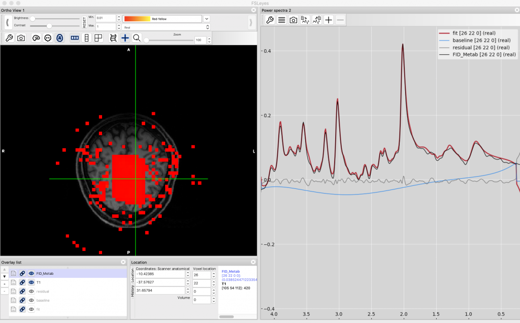 Reproducible Research Insights with William T. Clarke and Saad Jbabdi ...